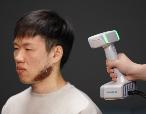 Einscan H2 Human Body & BodyParts 3D Scanner - Graft 3D